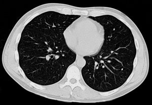 Chest Imaging - Regional Radiology Group